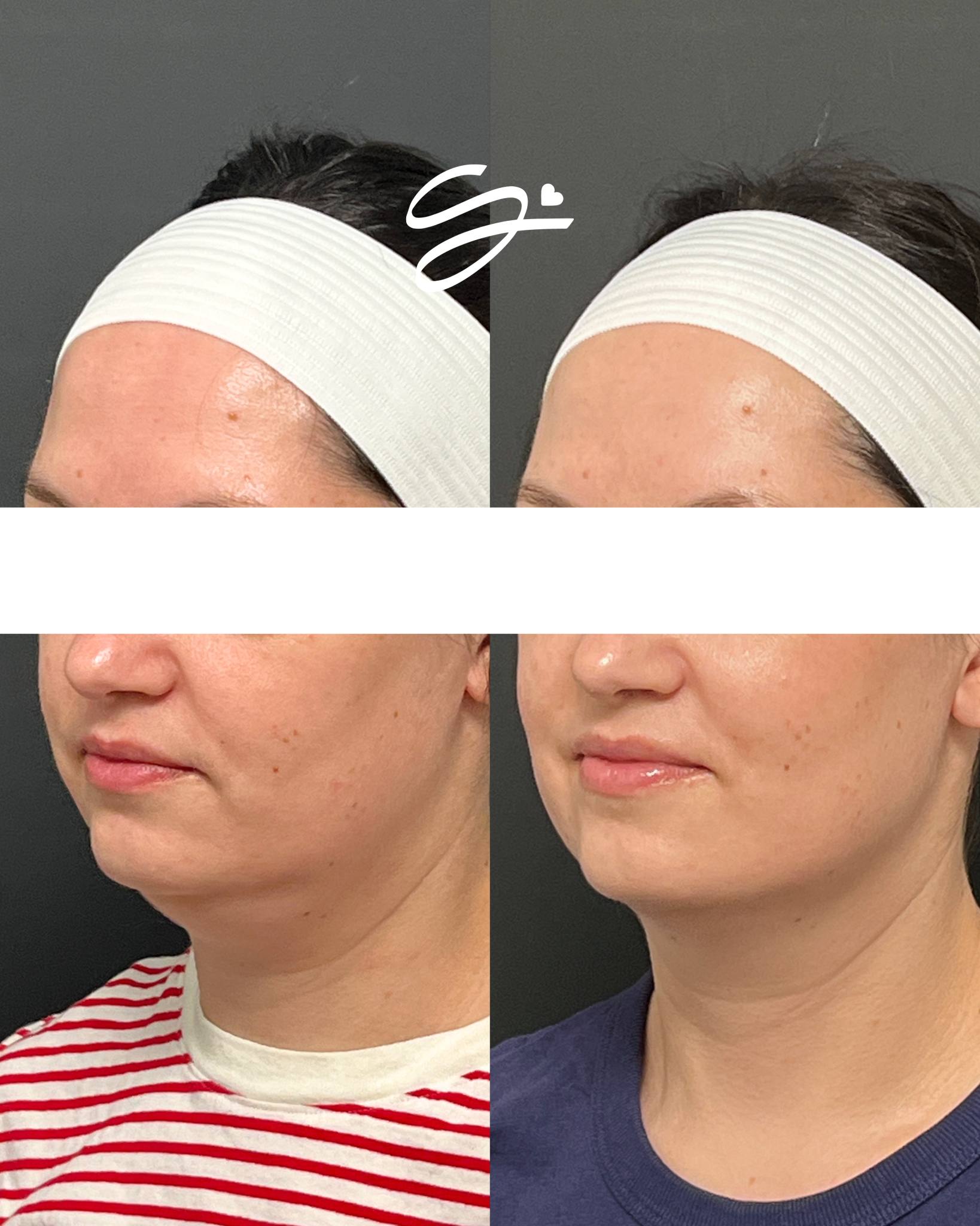 The Science of Snatched: How to Achieve a Sculpted Face
